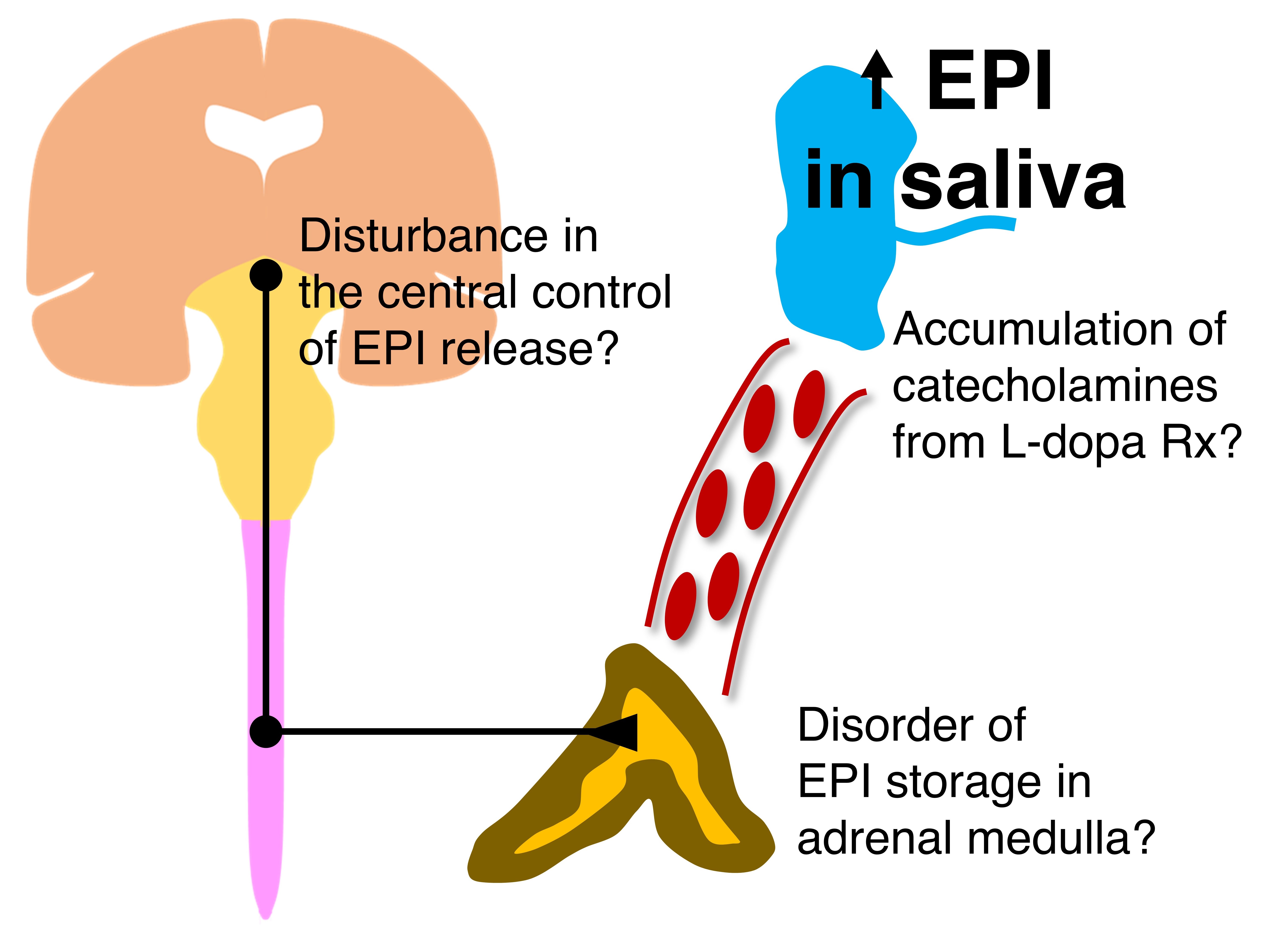 Increased Epinephrine In The Saliva Of Parkinson s Disease Patients A 